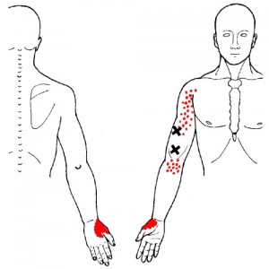 The Definitive Guide to Brachialis Anatomy, Exercises & Rehab