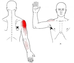 The Definitive Guide to Teres Major Anatomy, Exercises & Rehab