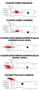 The Definitive Guide to Wrist Flexors Anatomy, Exercises & Rehab